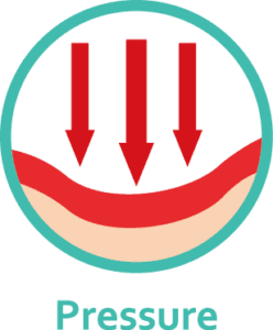 What Are Pressure Sores? | KARMA Medical