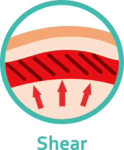 What Are Pressure Sores? | KARMA Medical